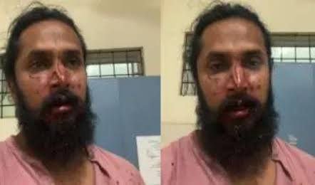 Mob attack on actor Chetan Chandra, the actor's nose was broken, he was ...